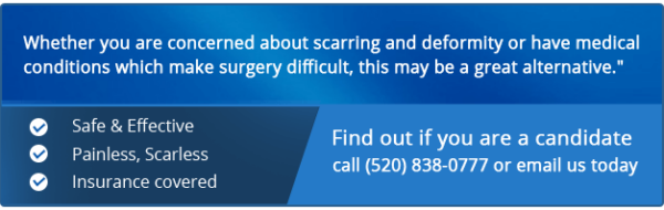 Non-Surgical Skin Cancer Removal - Dyson Dermatology