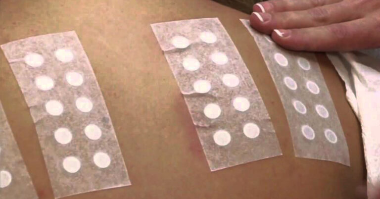 Medical Procedures - Dyson Dermatology